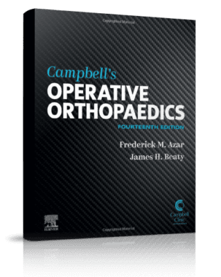Operative Orthopaedics | Campbell Clinic Foundation